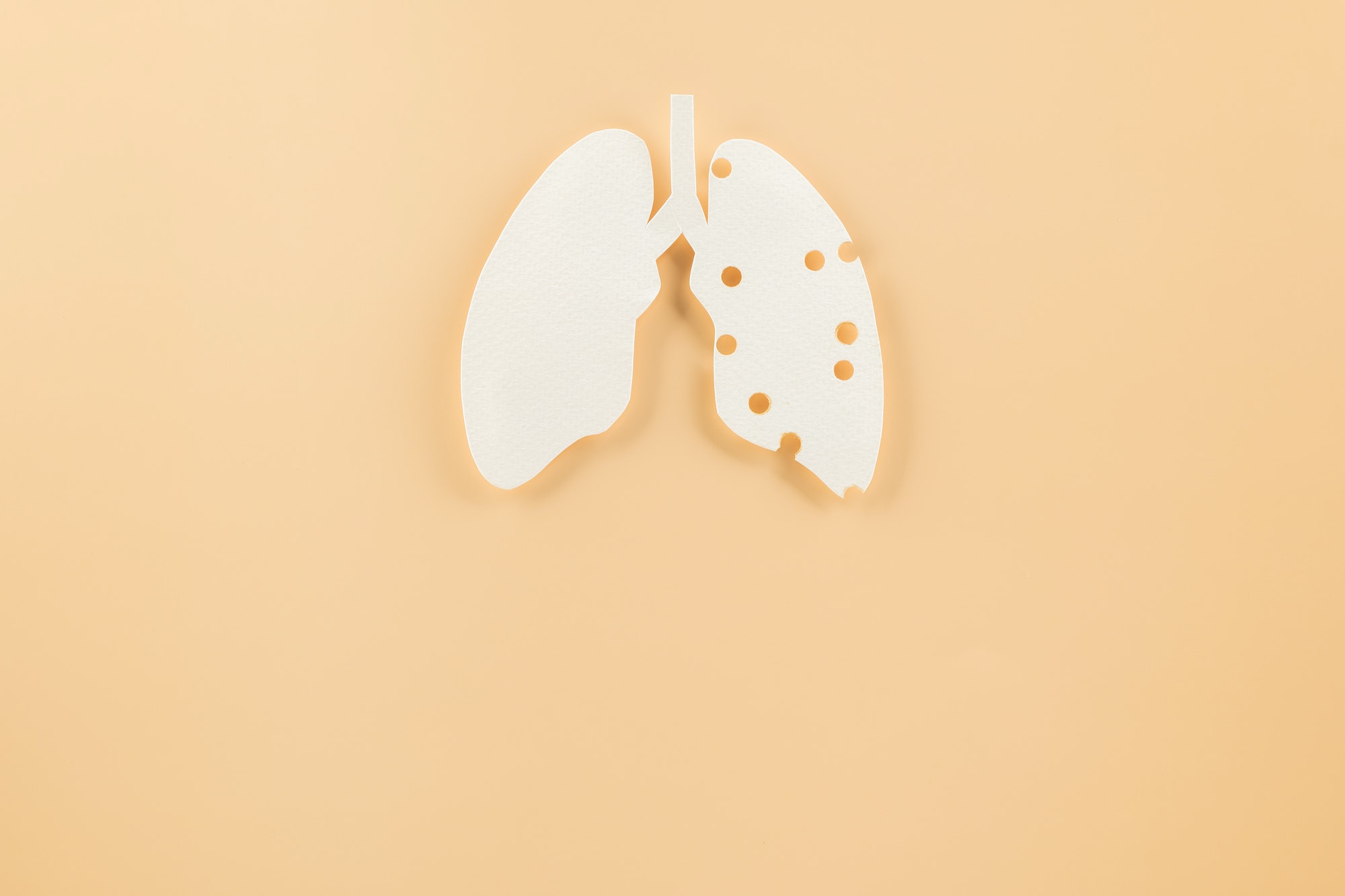 ΥΓΡΟ ΣΤΟΝ ΠΝΕΥΜΟΝΑ : ΤΙ ΜΠΟΡΕΙ ΝΑ ΣΥΜΒΑΙΝΕΙ; — ΚΛΗΜΑΤΣΙΔΑΣ ΜΙΧΑΛΗΣ MD, PhD